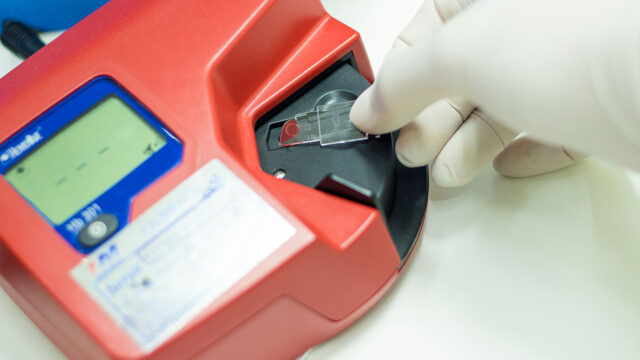 Sistemi POCT: opportunità e soluzioni sul mercato - Healthtech360